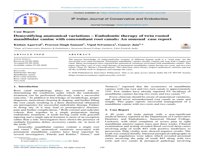 Demystifying anatomical variations – Endodontic therapy of twin rooted ...